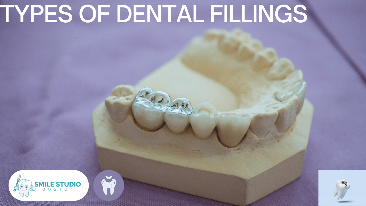 Choosing the Right Option: What Are the Different Types of Dental ...