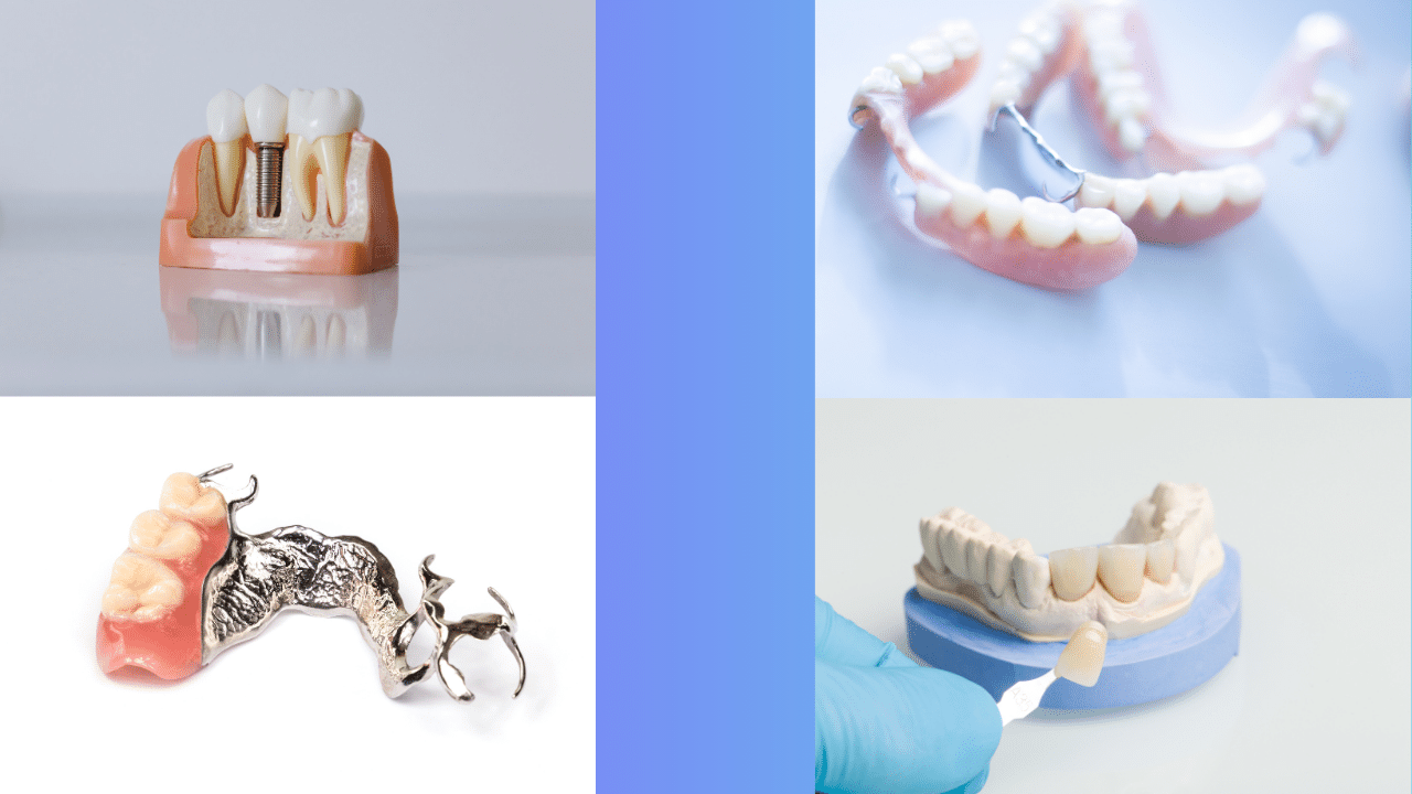 What Are The Four Types Of Dentures? - Smile Studio Boston