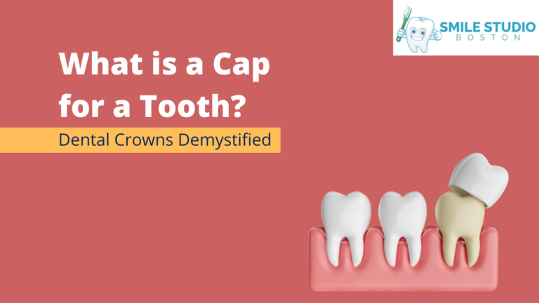 Dental Crowns Demystified: What is a Cap for a Tooth - Smile Studio Boston