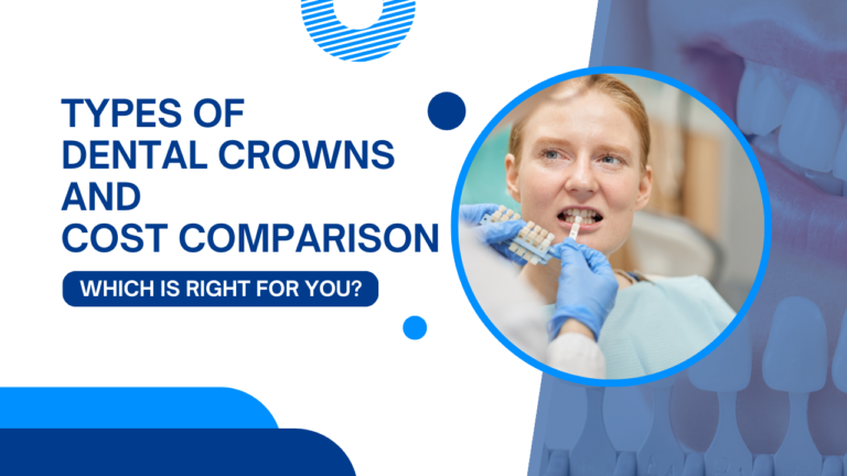 Types of Dental Crowns and Cost Comparison: Which is Right for You ...