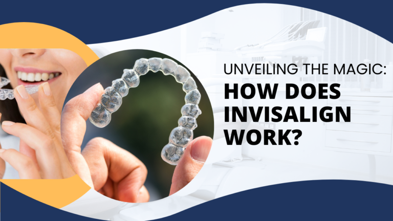 Unveiling the Magic: How Does Invisalign Work? - Smile Studio Boston