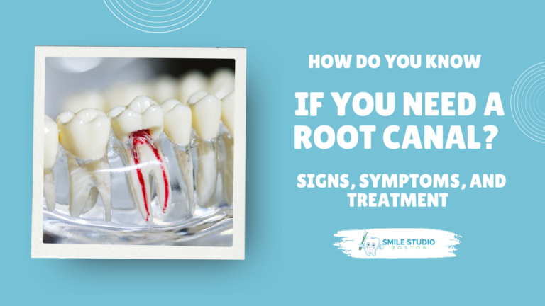 How Do You Know If You Need a Root Canal? Signs, Symptoms, and ...