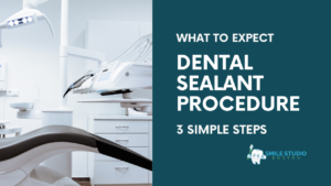 Dental Sealant Procedure in 3 Simple Steps: What to Expect - Smile ...