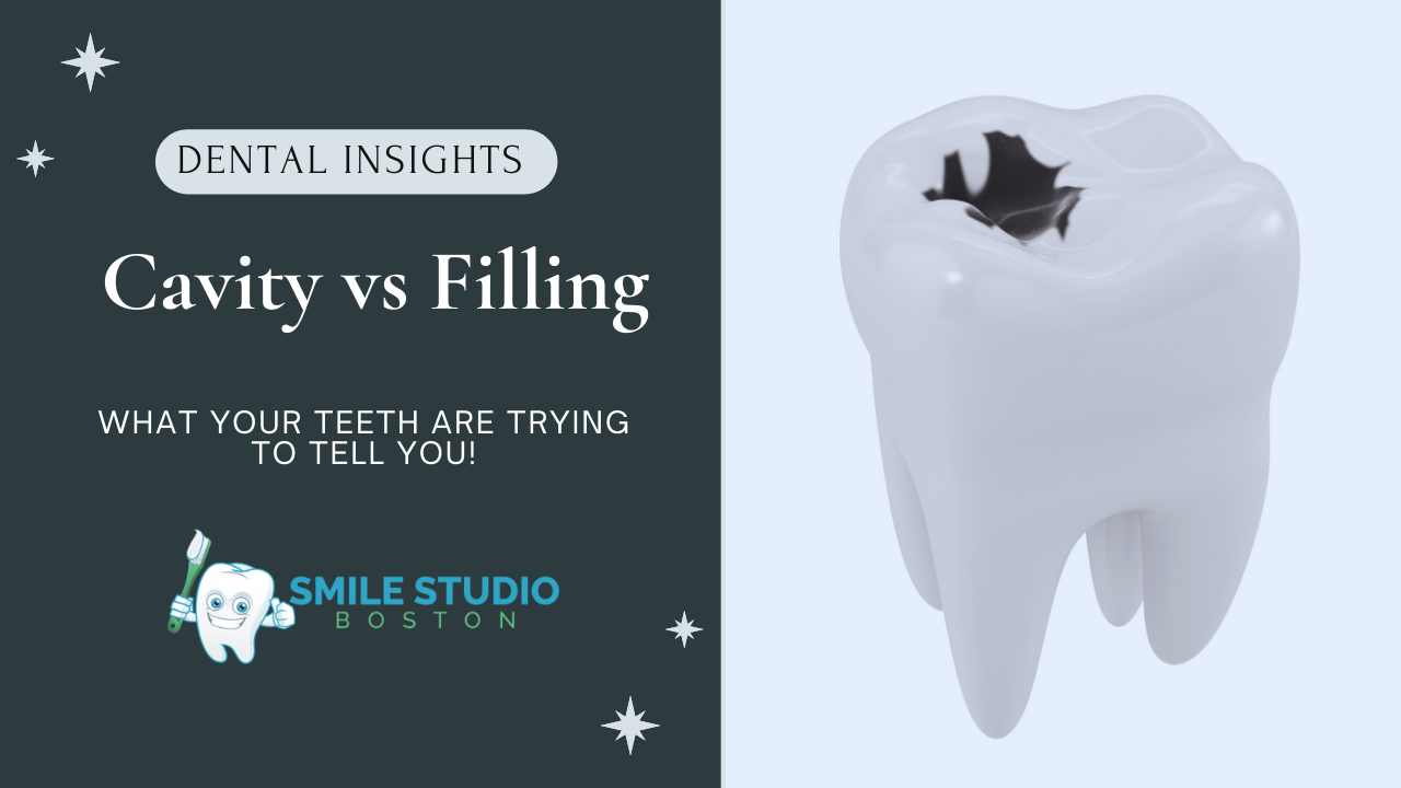 Cavity vs Filling – What Your Teeth Are Trying to Tell You! - Smile ...