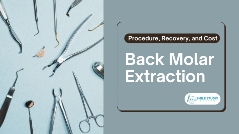 Back Molar Extraction: Procedure, Recovery, and Cost - Smile Studio Boston
