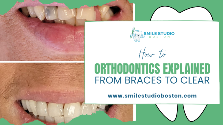 Orthodontics Explained: From Braces to Clear - Smile Studio Boston